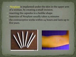 Polymer membrane permeation cdds | PPT