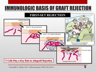 Transplantation Immunology -by Samruddhi Shinde | PPT