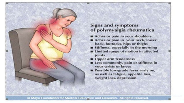 Polymyalgia rheumatica | PPTX