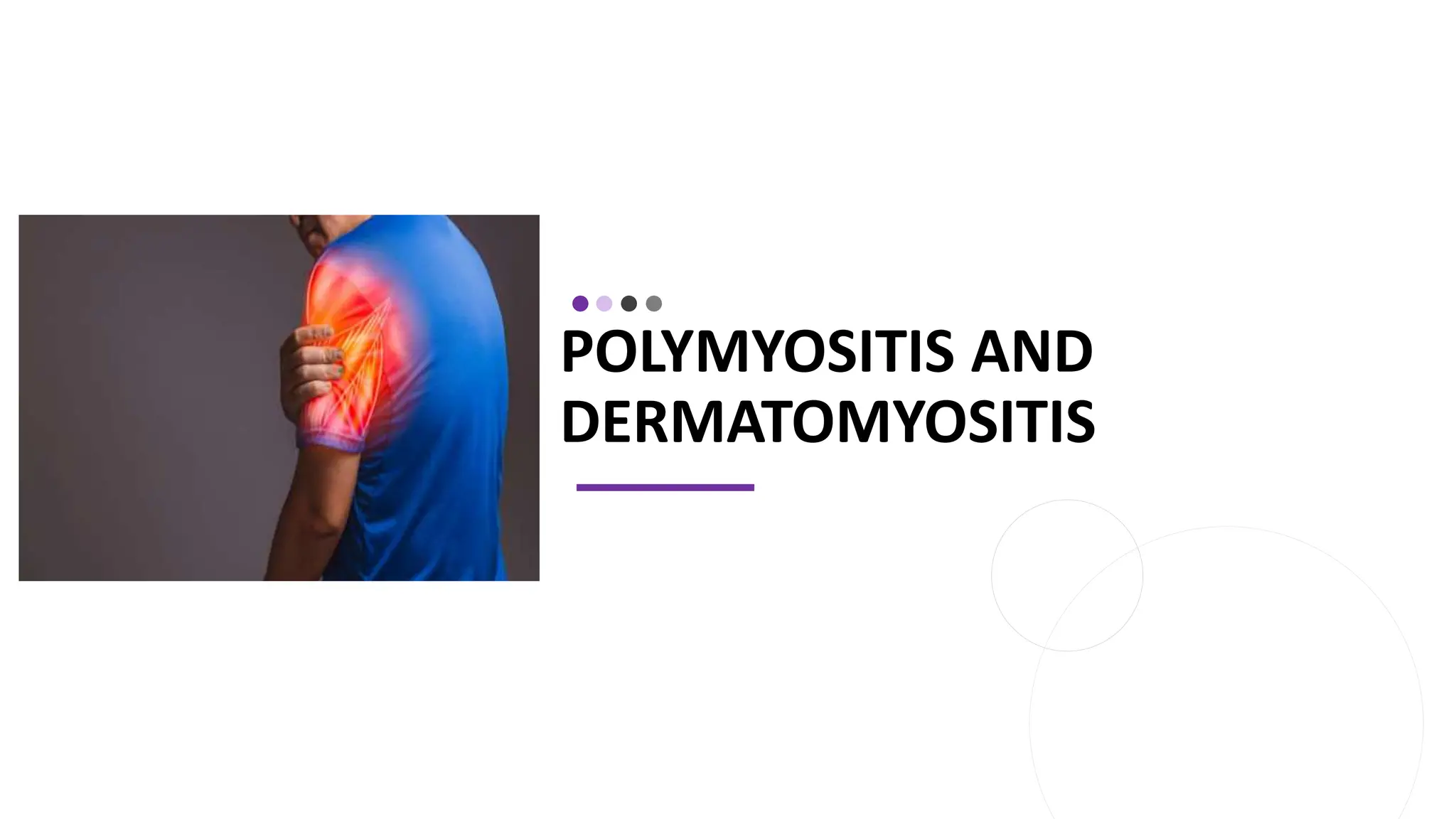 Exploring Polymyositis and Dermatomyositis: Understanding the Intricacies of These Autoimmune ...