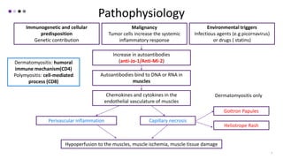 Exploring Polymyositis and Dermatomyositis: Understanding the ...