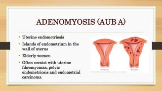 polyp and adenomyosis.pptx