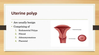 polyp and adenomyosis.pptx