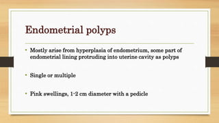 polyp and adenomyosis.pptx