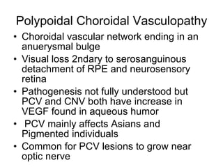 Polypoidal Choroidal Vasculopathy | PPT