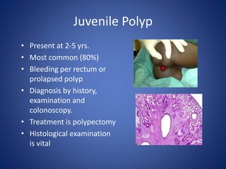 Polypoid diseases of git | PPT