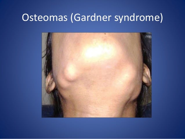 Polypoid diseases of git