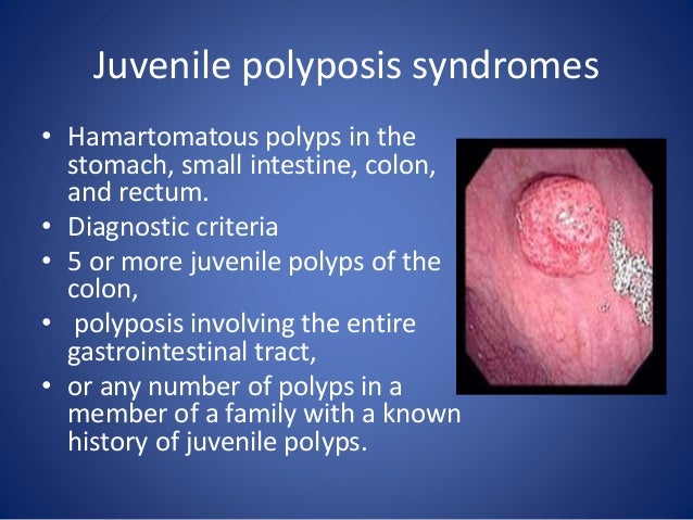Polypoid diseases of git