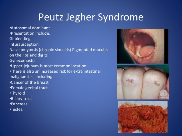 Polypoid diseases of git
