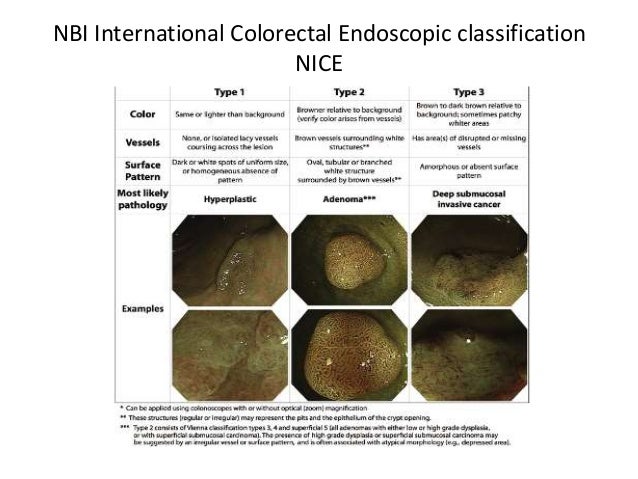 Colorectal Polyps & Carcinomas Diagnosis & characterization