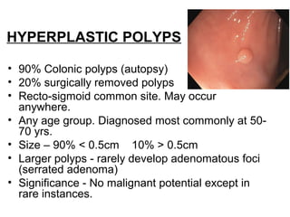 Polyps and malignancy of large bowel | PPT