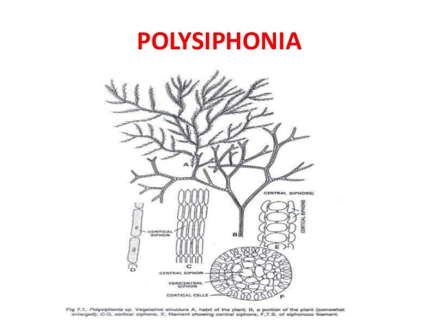 General Characters of Rhodophyceae & Life Cycle of Polysiphonia S…