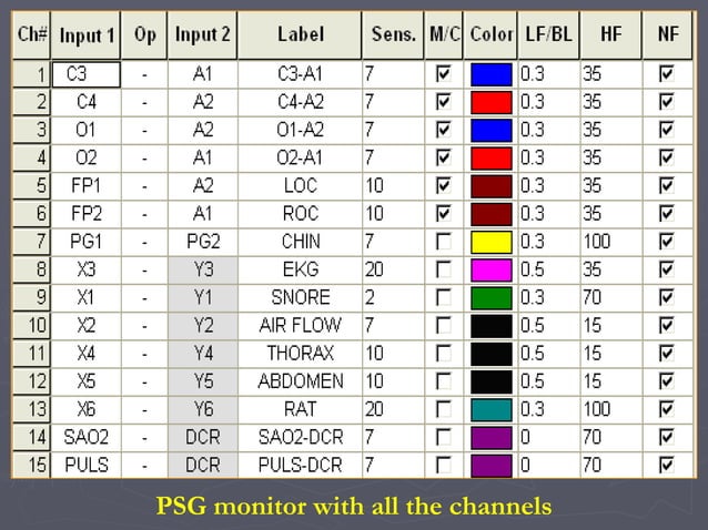 Polysomnography: recording and sleep staging