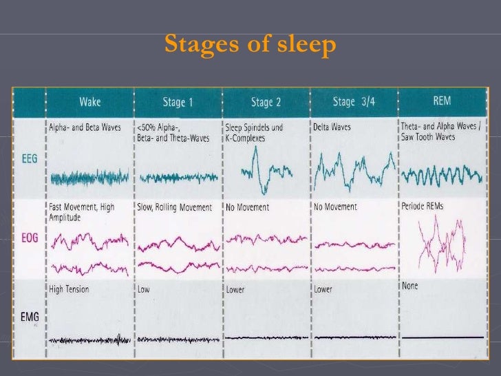 Polysomnography: recording and sleep staging