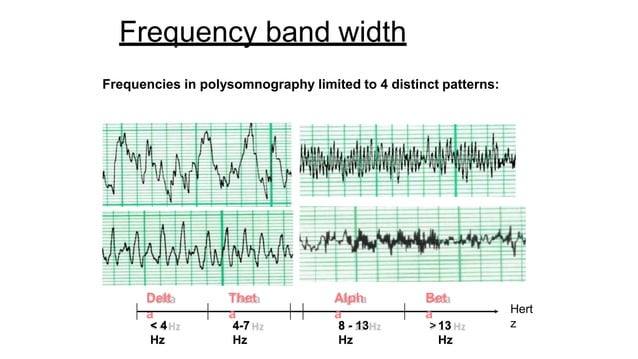 Polysomnography | PPTX