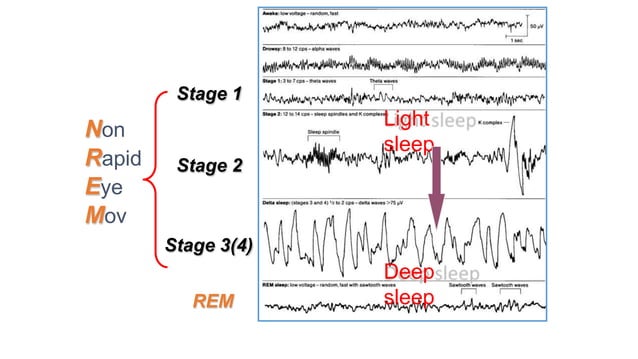 Polysomnography | PPTX