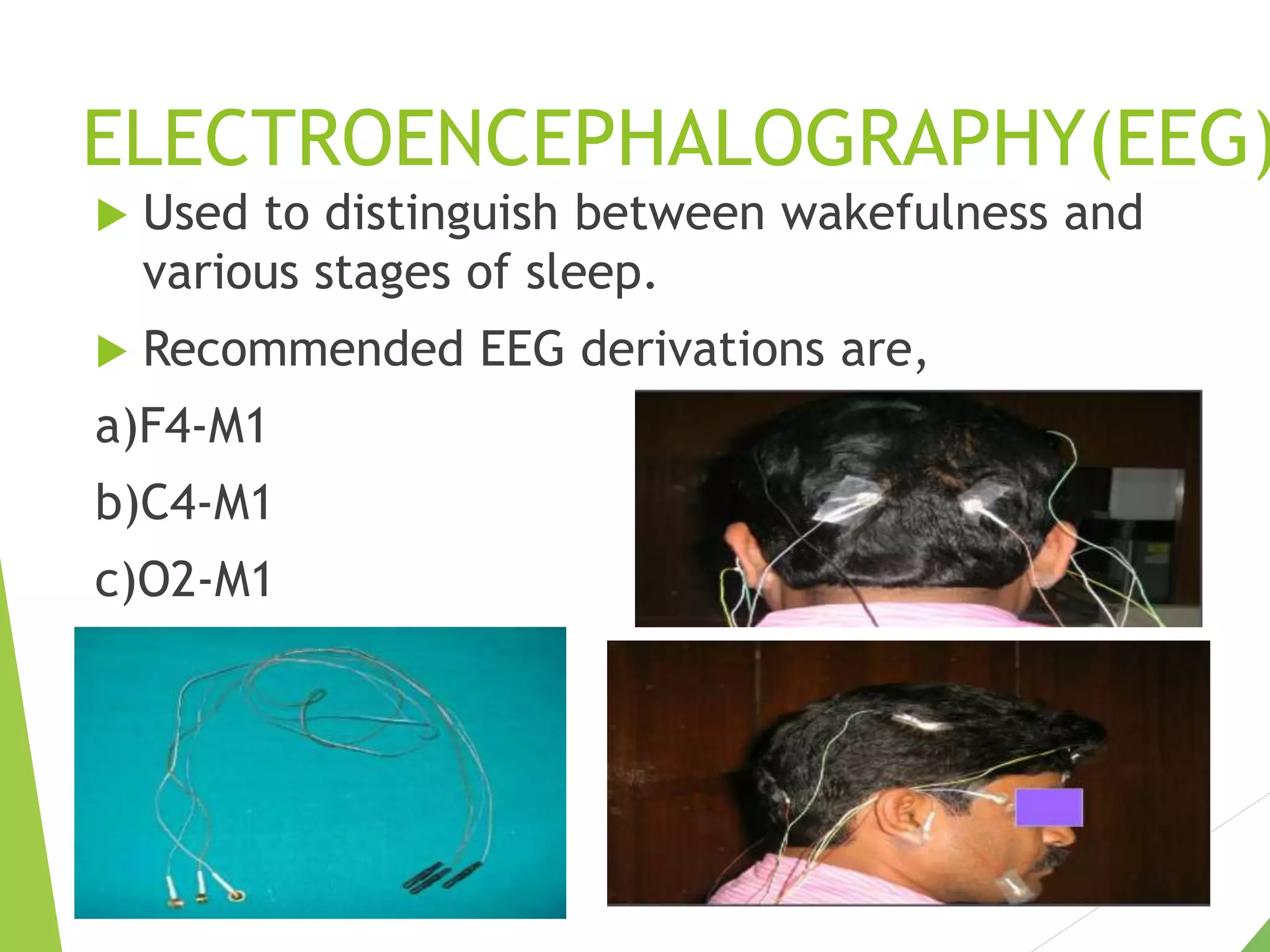 Polysomnography (sleep study) | PPTX