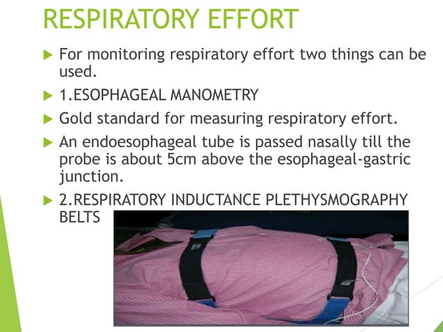 Polysomnography (sleep study) | PPTX | Ear, Nose and Throat Conditions ...