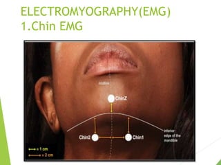 Polysomnography (sleep study) | PPTX