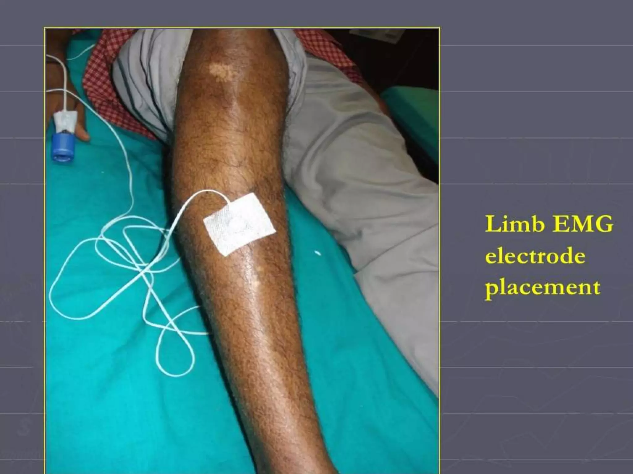 Polysomnography | PPTX