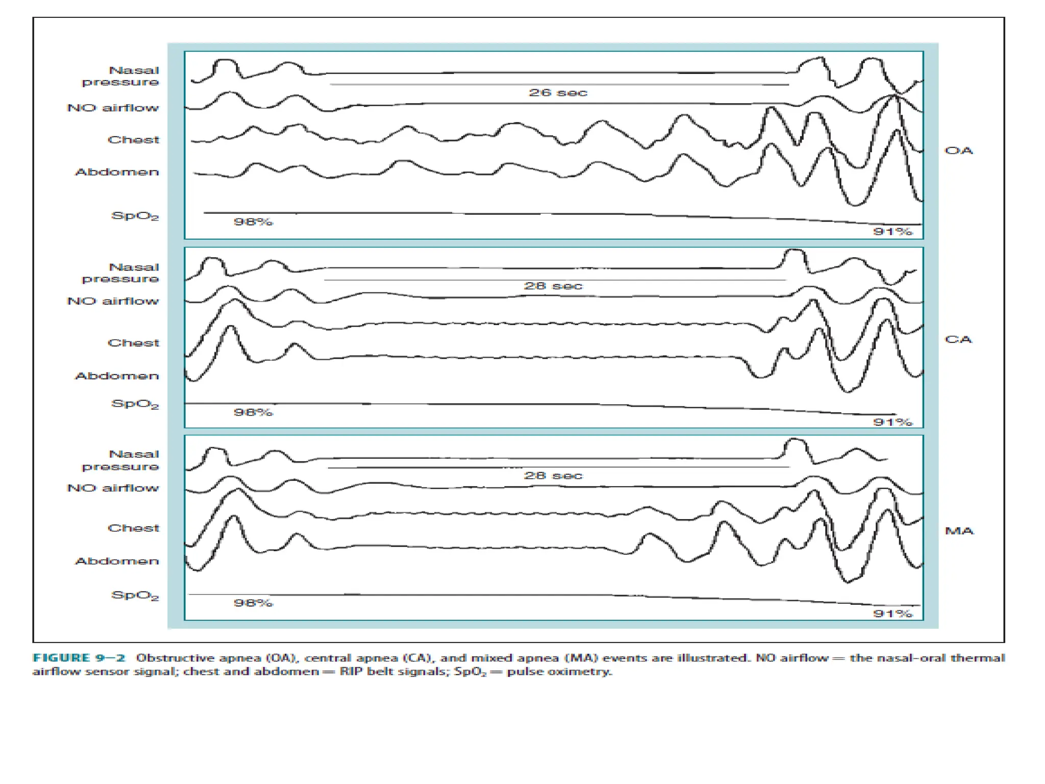 basic of polysomnography presentation.pptx