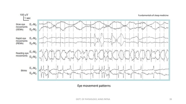 Polysomnography | PDF