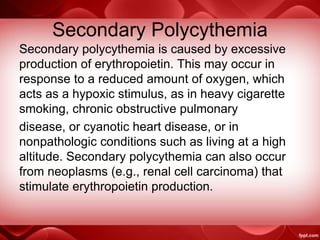 polysythemia.ppt