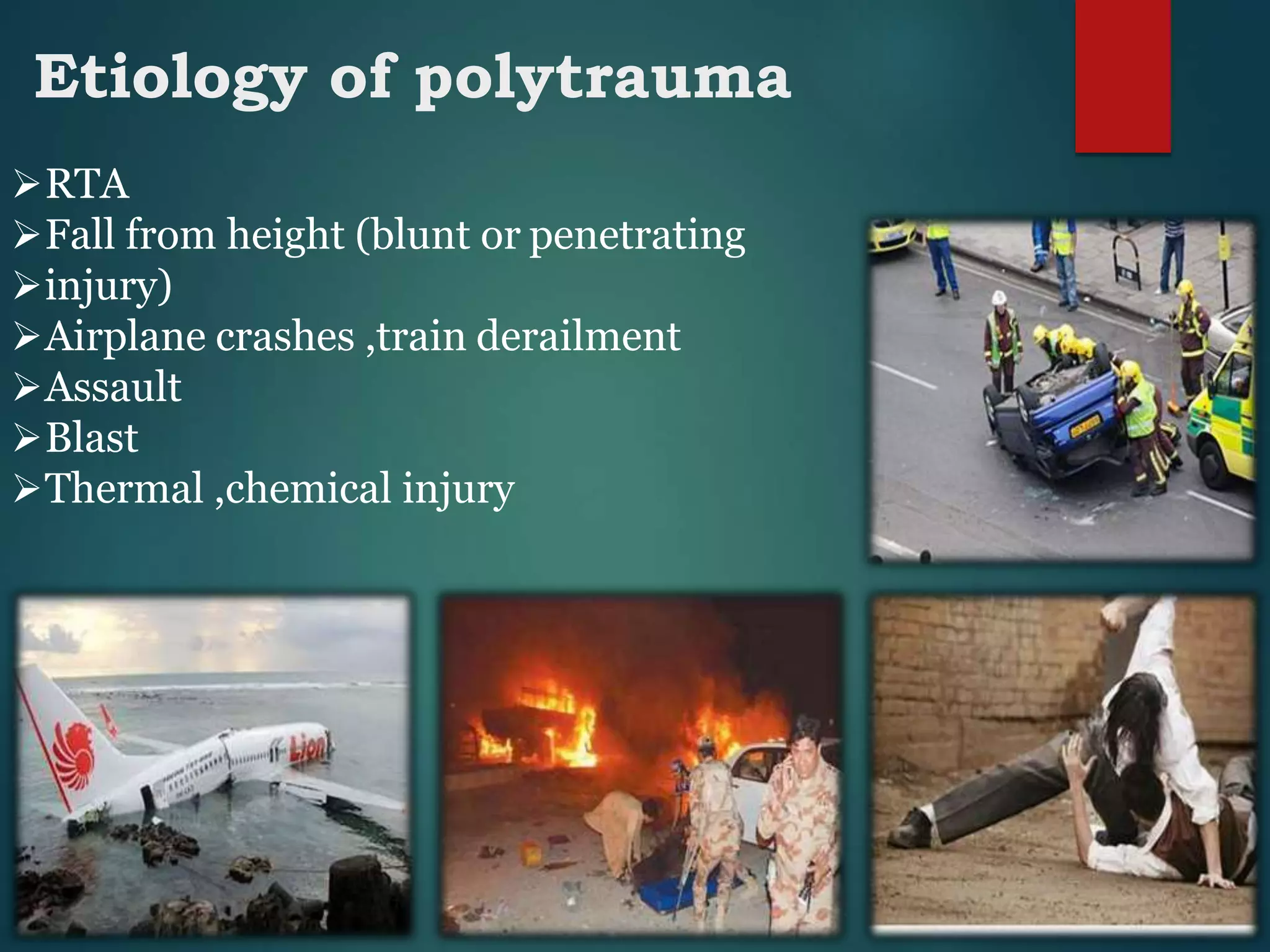 Polytrauma | PPTX