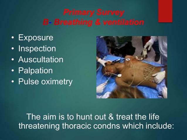 Polytrauma | PPTX | First Aid | Injuries