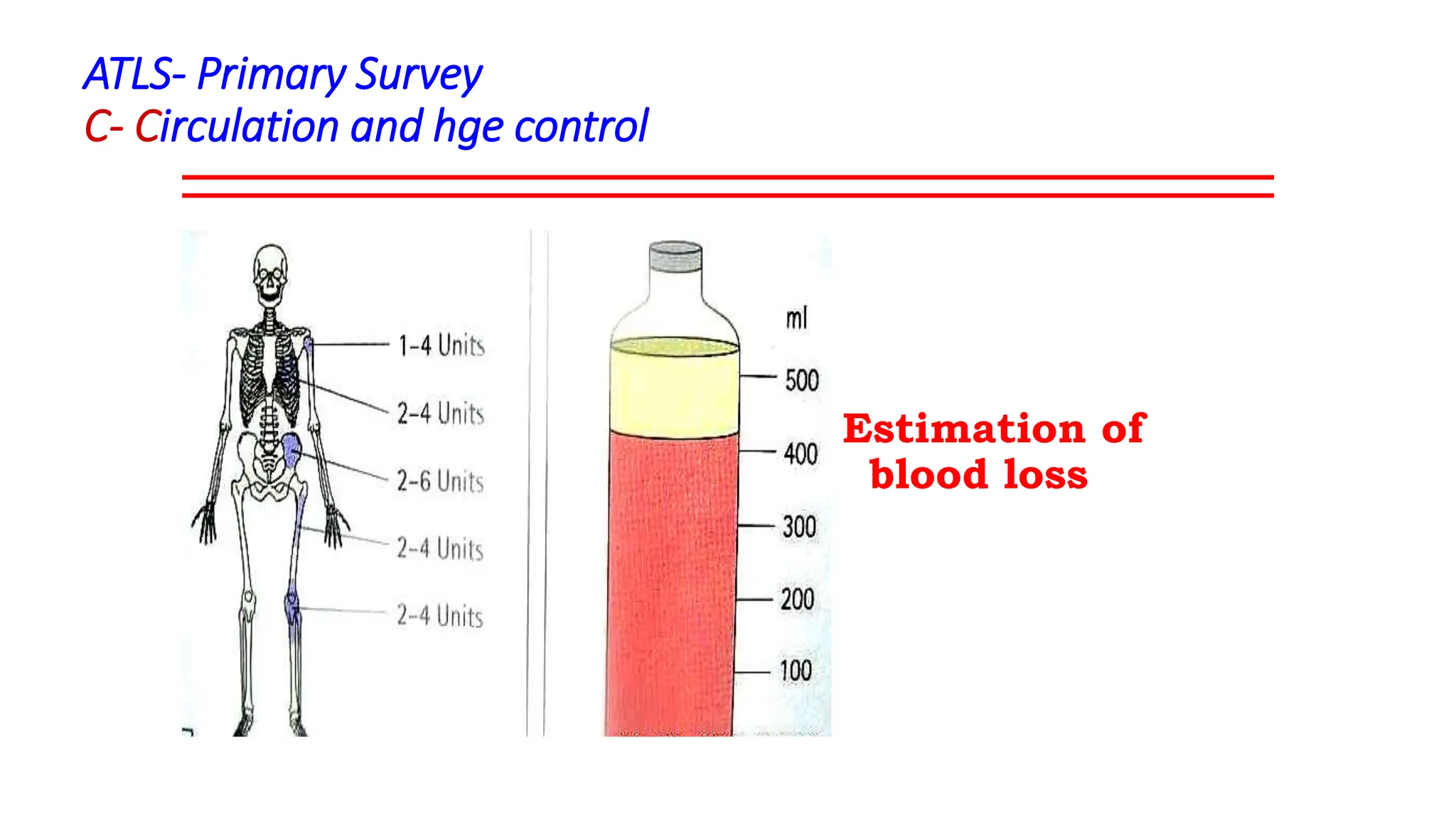 ATLS polytrauma_Final Mangement ASI 2.ppt