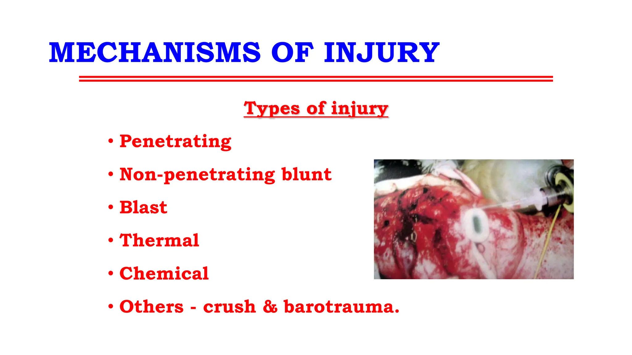 ATLS polytrauma_Final Mangement ASI 2.ppt