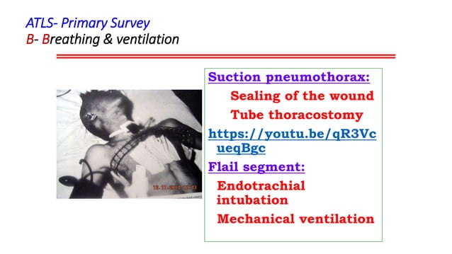 ATLS polytrauma_Final Mangement ASI 2.ppt