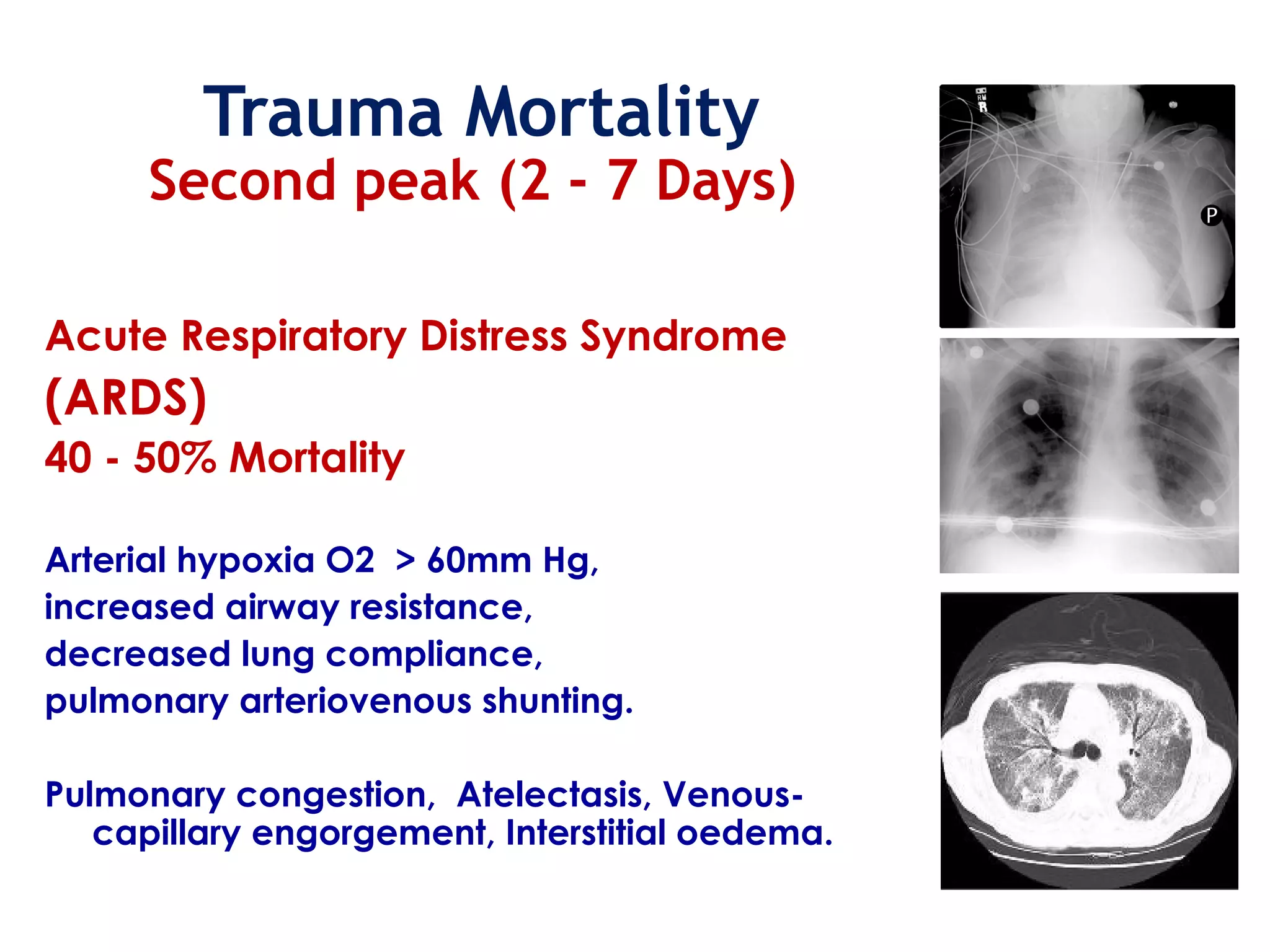Polytrauma part 1 (overview) | PPT