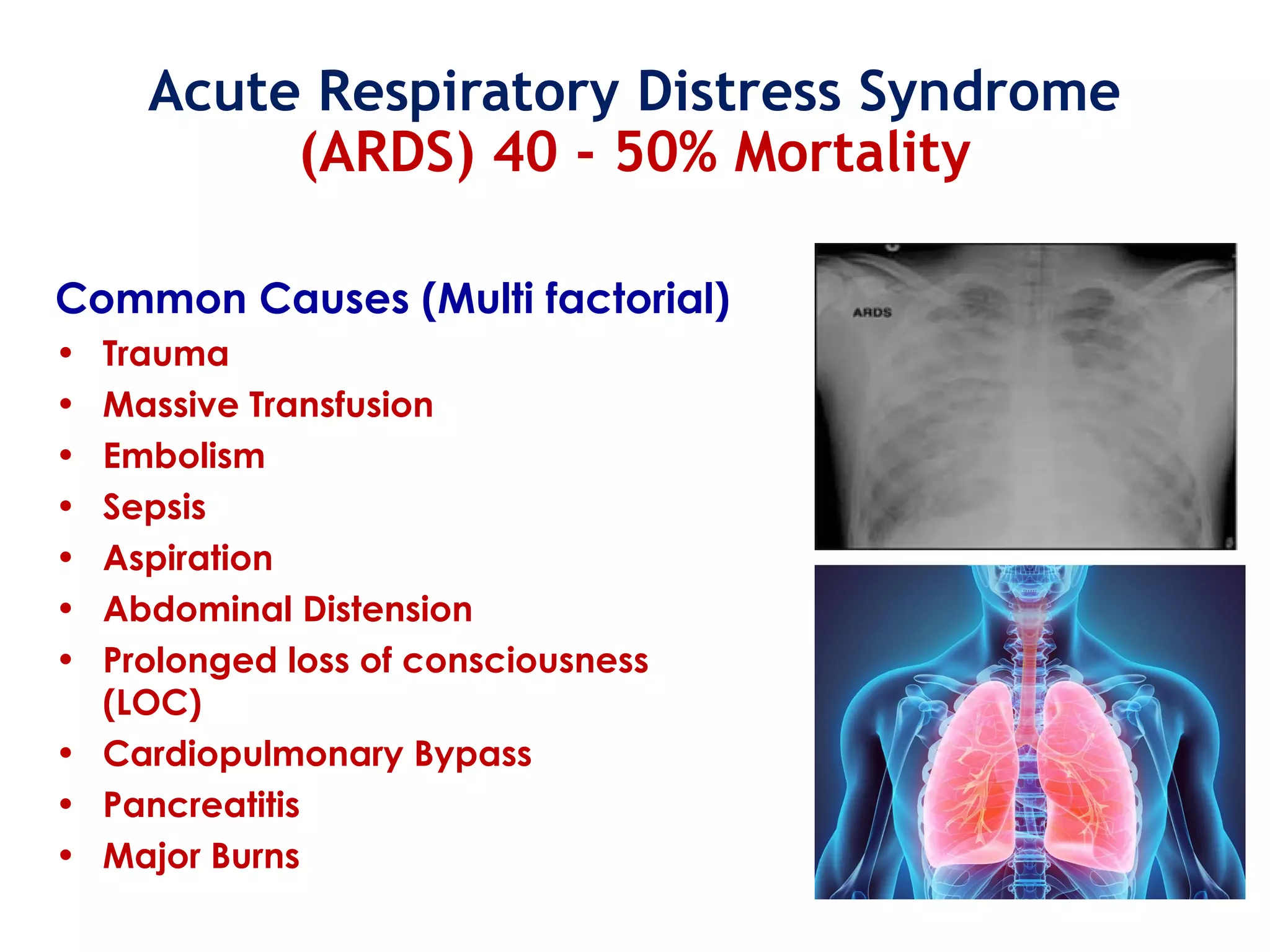 Polytrauma part 1 (overview) | PPT