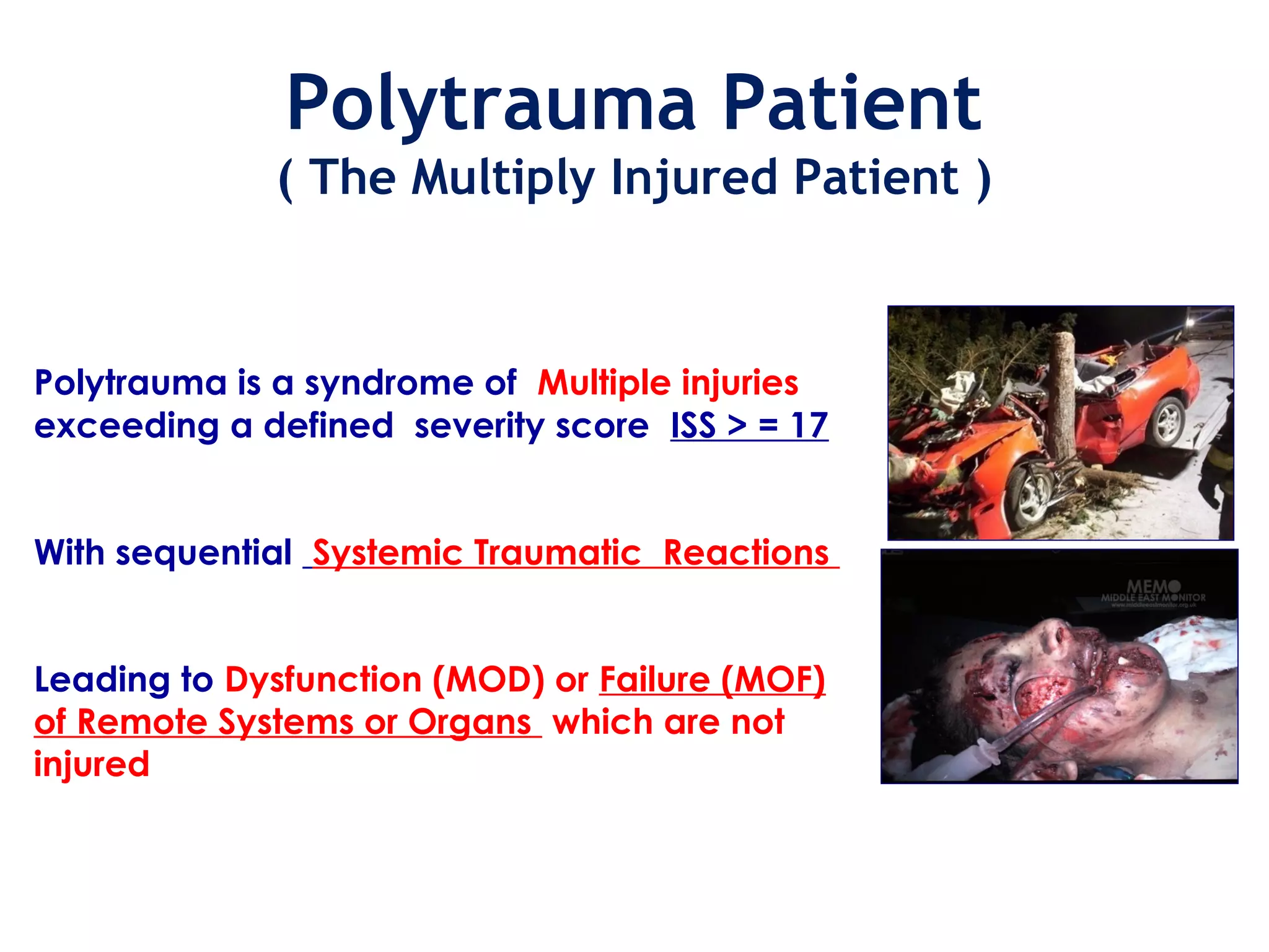 Polytrauma part 1 (overview) | PPT