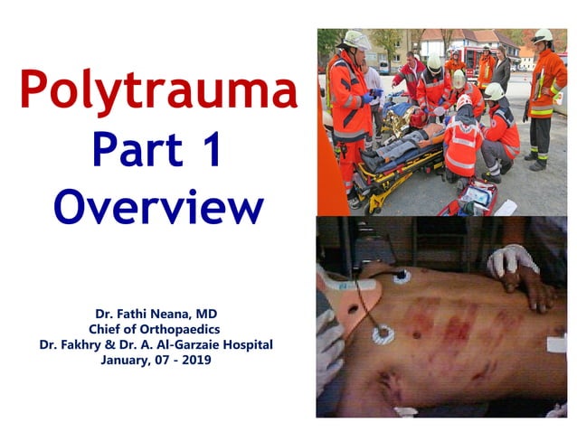Polytrauma part 1 (overview) | PPT | Death, Injury, or Military ...
