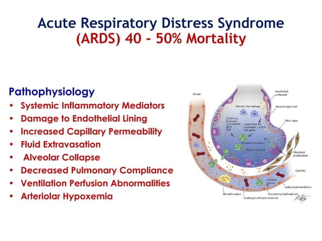 Polytrauma part 1 (overview) | PPT | Death, Injury, or Military ...