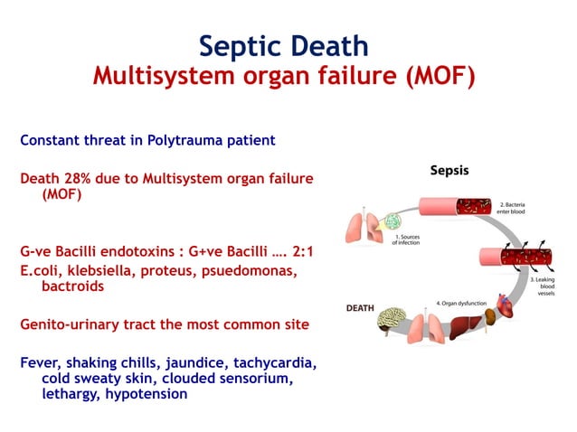 Polytrauma part 1 (overview) | PPT | Death, Injury, or Military ...