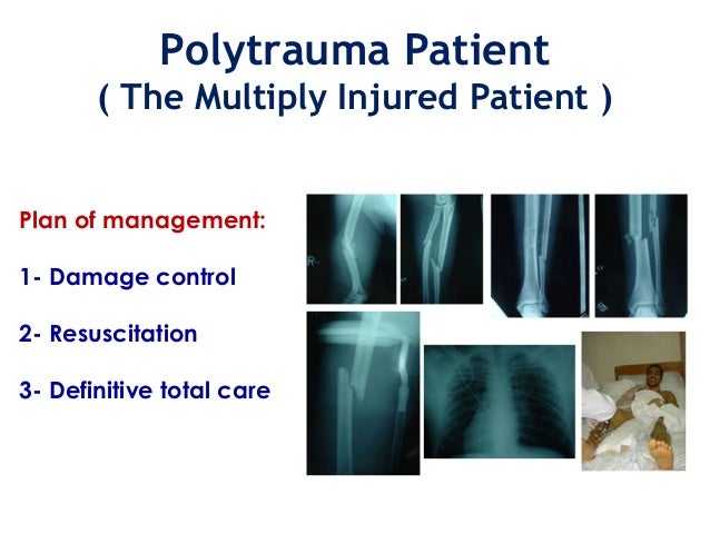 Polytrauma part 1 (overview)