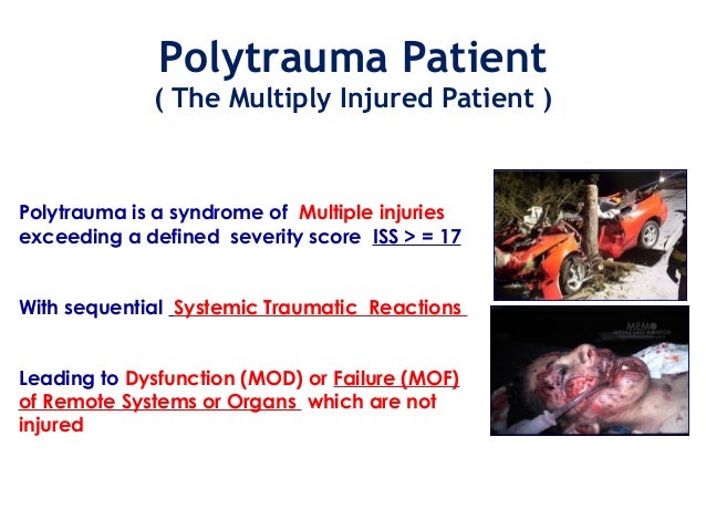 Polytrauma part 1 (overview)
