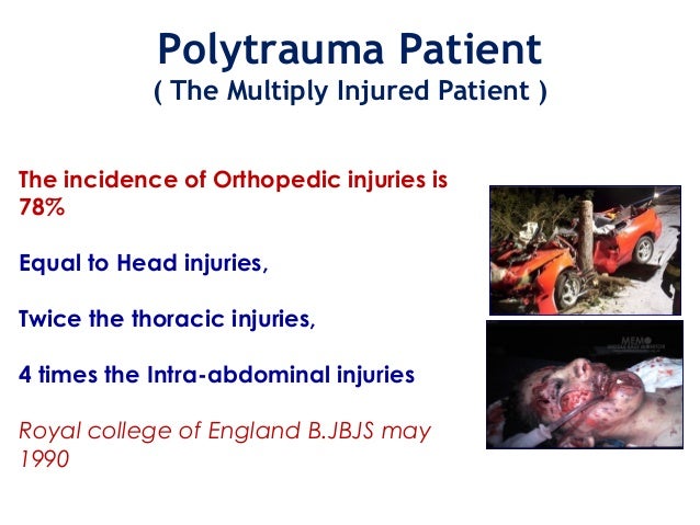 Polytrauma part 1 (overview)