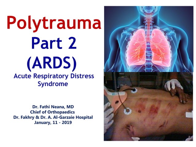Polytrauma part 2 (ards) | PPT | Lung and Respiratory Health | Diseases ...