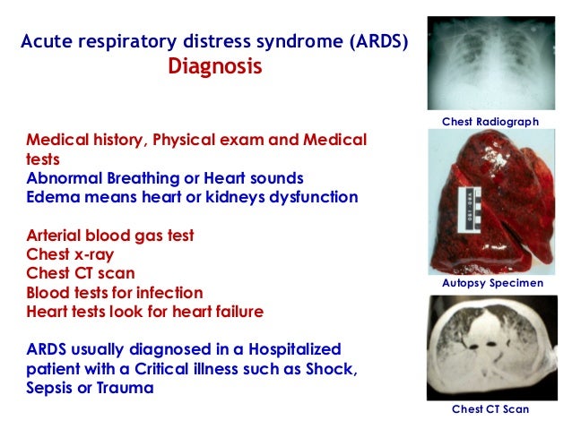 Pulmonary barotrauma symptoms - Grosfleet