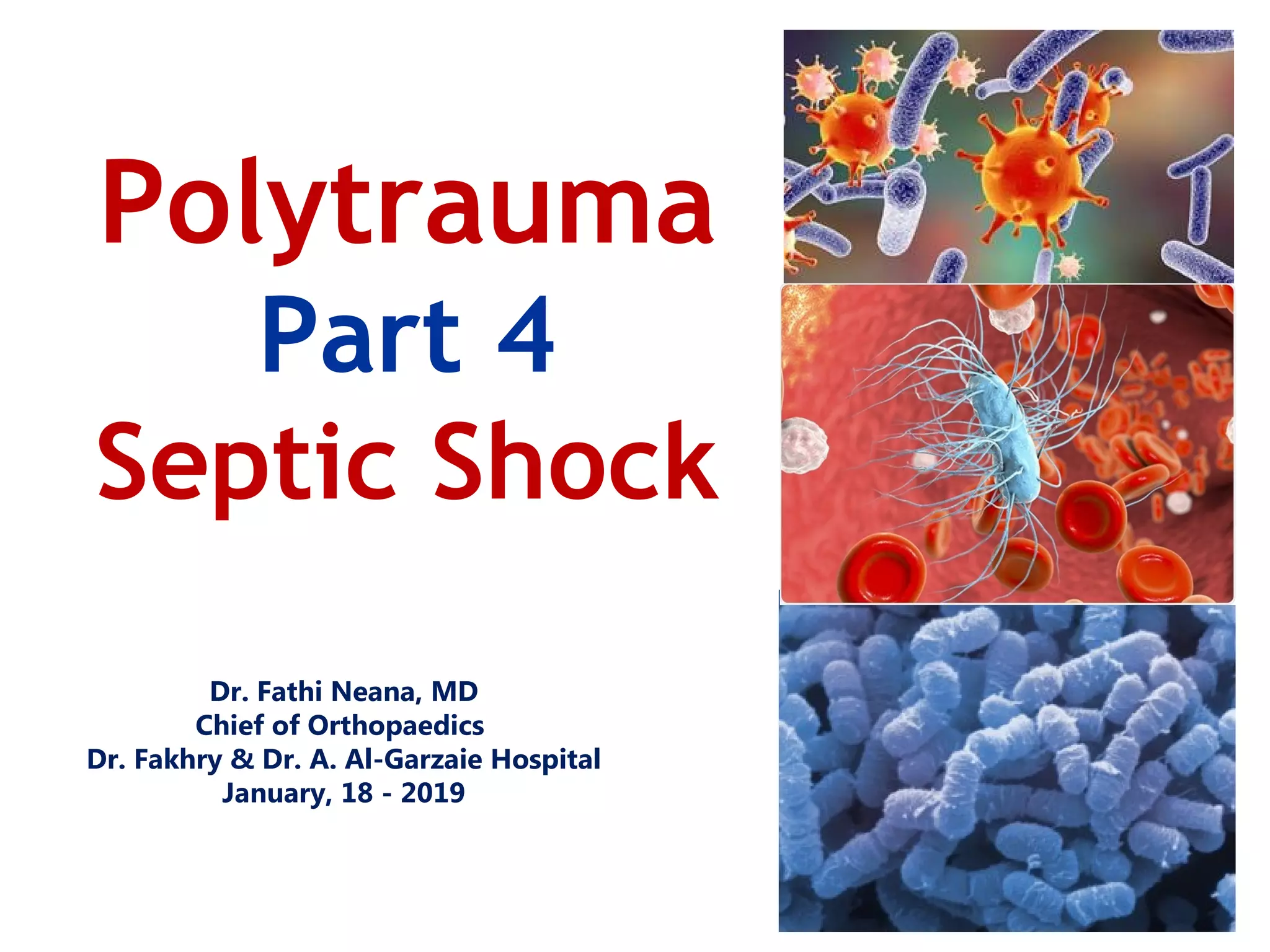 Polytrauma part 4 (SEPSIS) | PPT