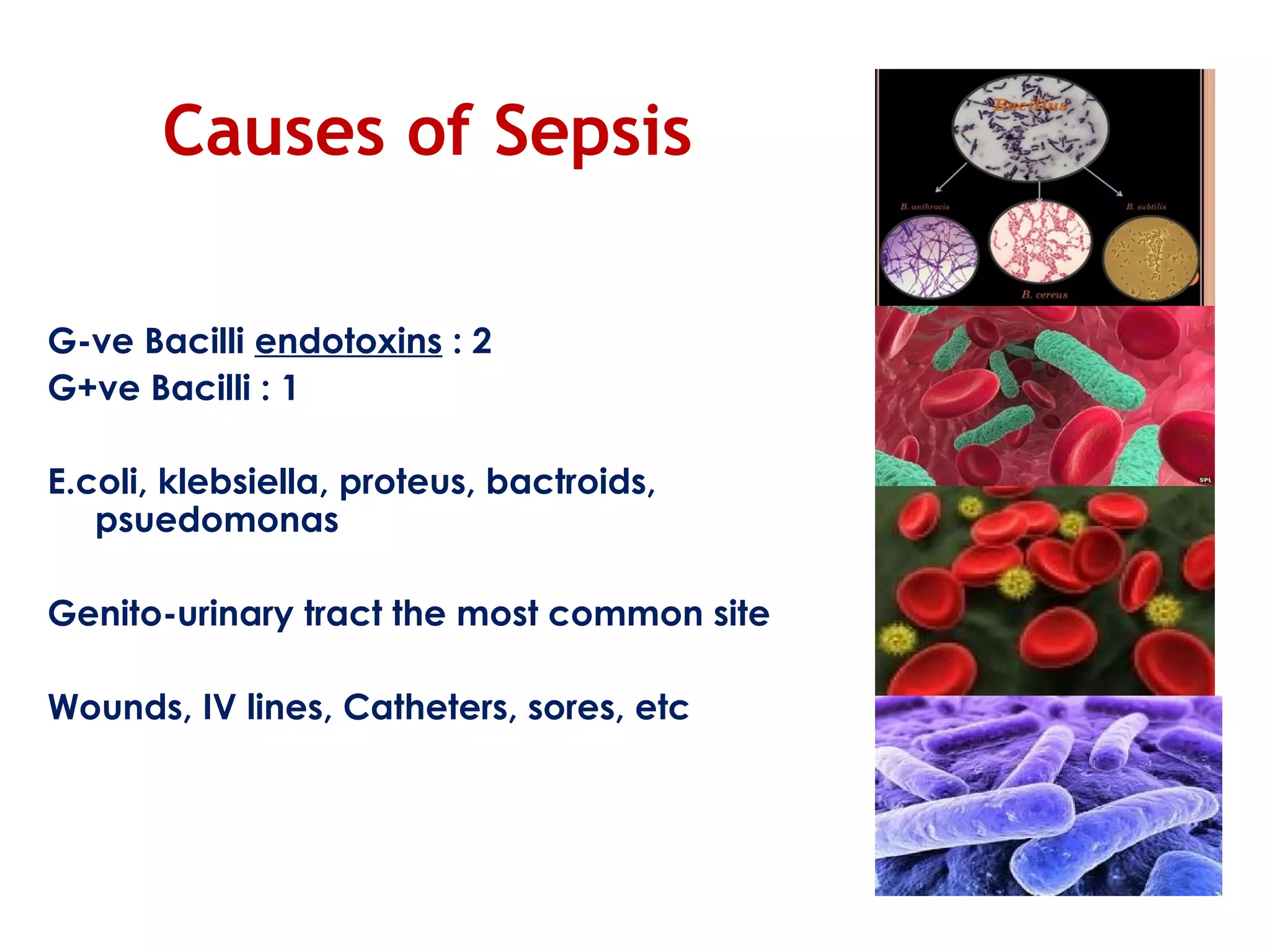 Polytrauma part 4 (SEPSIS) | PPT