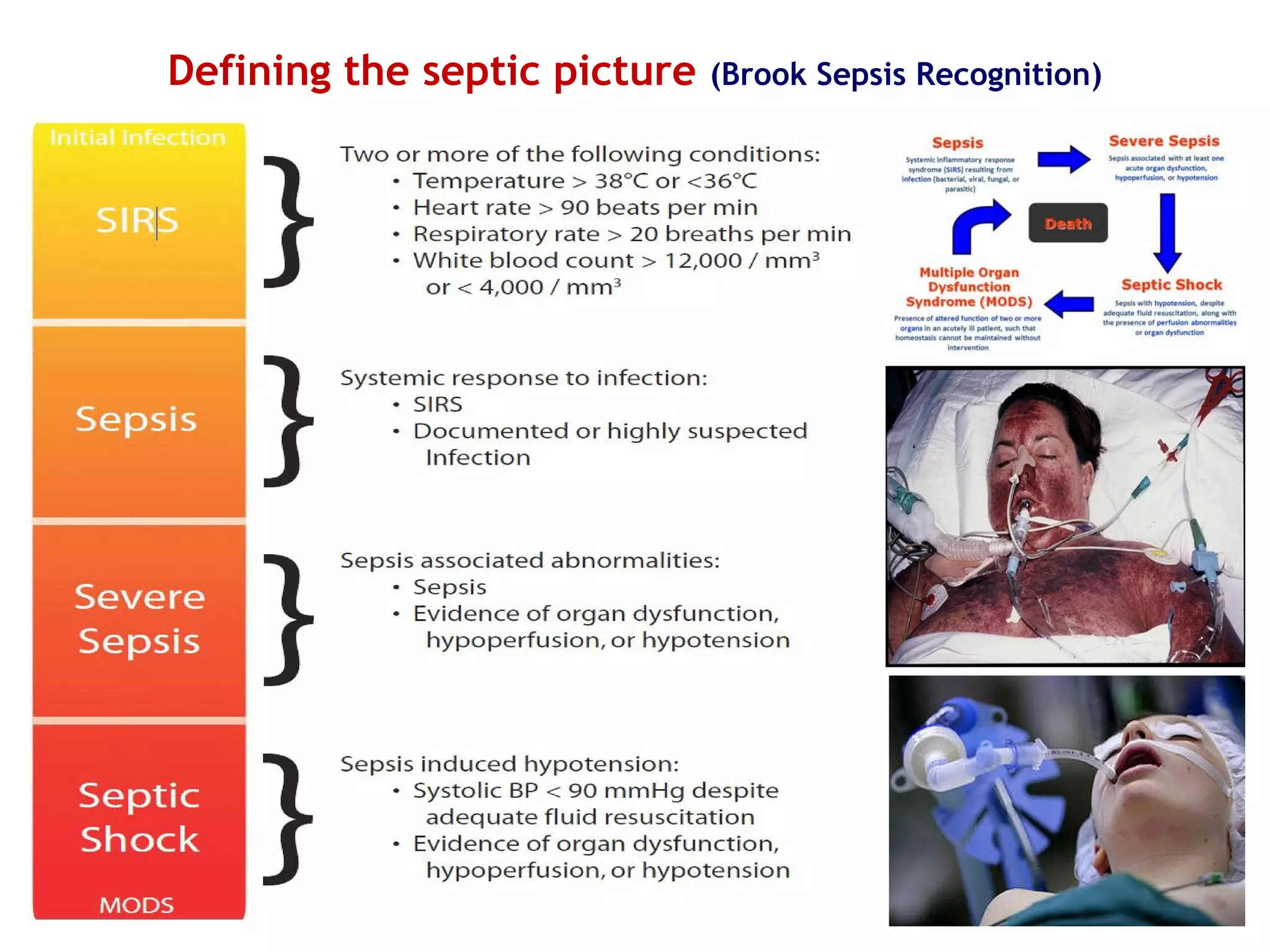 Polytrauma part 4 (SEPSIS) | PPT
