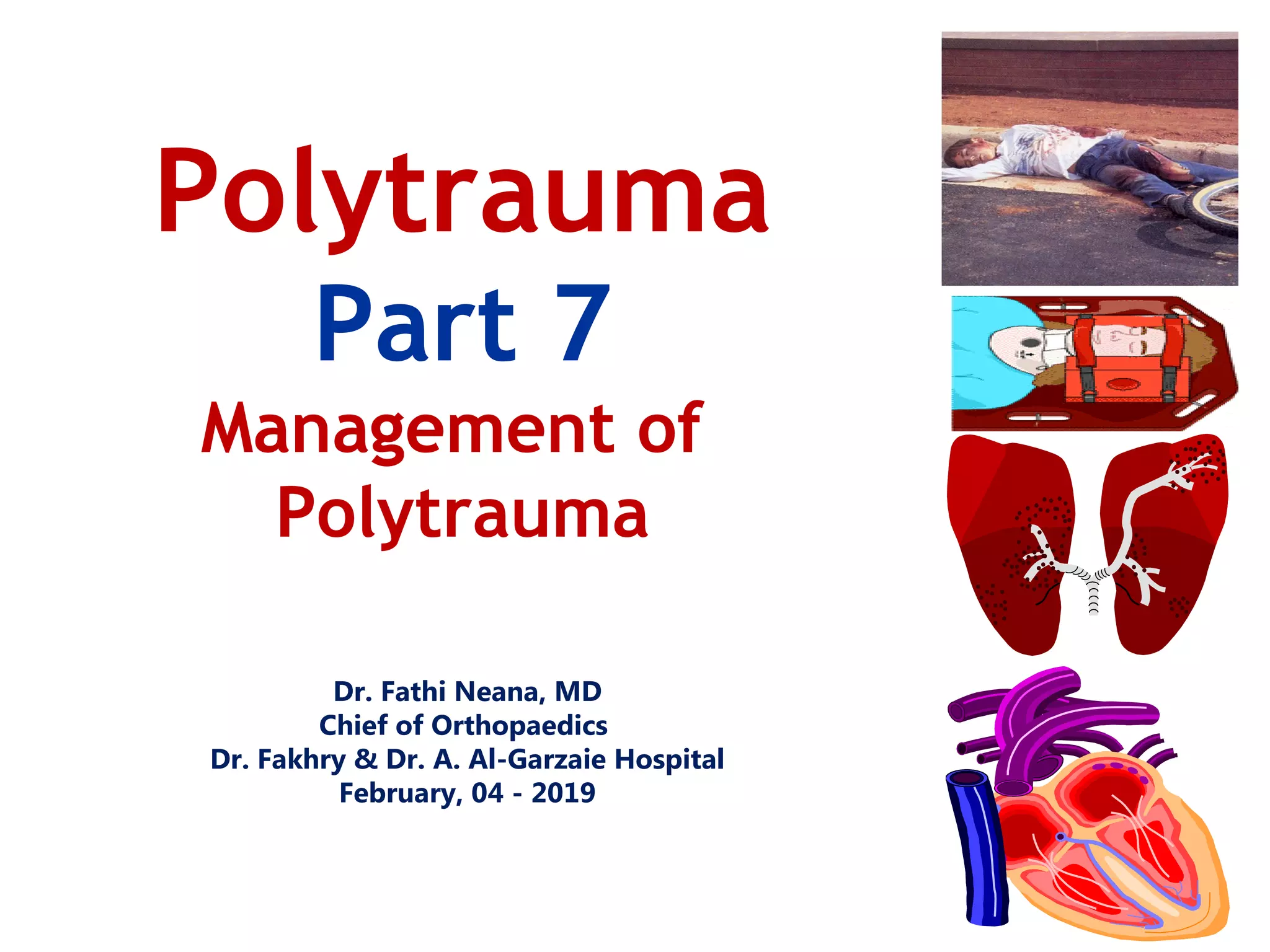 Polytrauma part 7 (Management) | PPT
