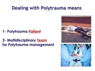 Polytrauma part 7 (Management) | PPT