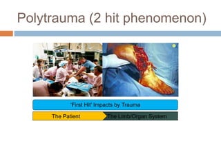 POLYTRAUMA AND DAMAGE CONTROL ORTHOPAEDICS | PPTX