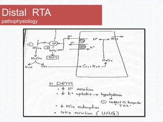 Polyuria : BASICS AND APPROACH | PDF